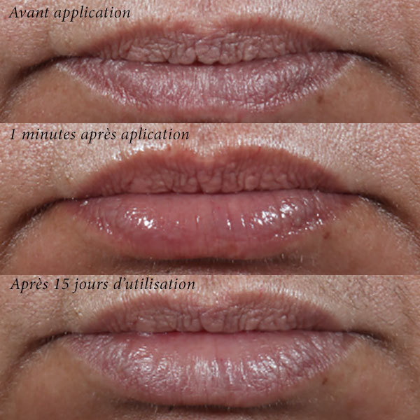 Wrinkled Lips Dehydration | Lipstutorial.org